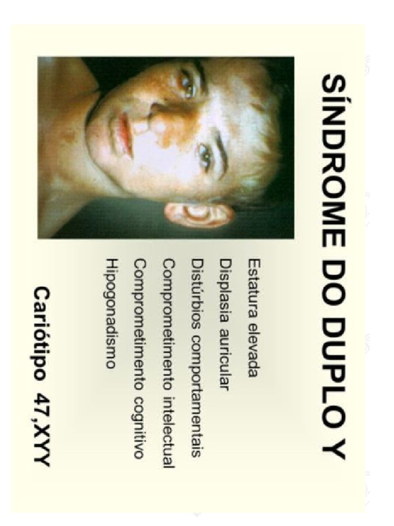SINDROME DE LA DOBLE Y.docx | PDF