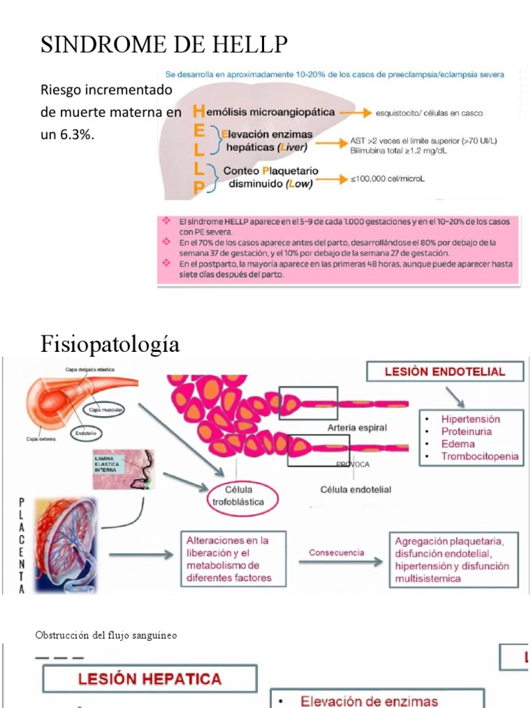 Sindrome de Hellp | PDF