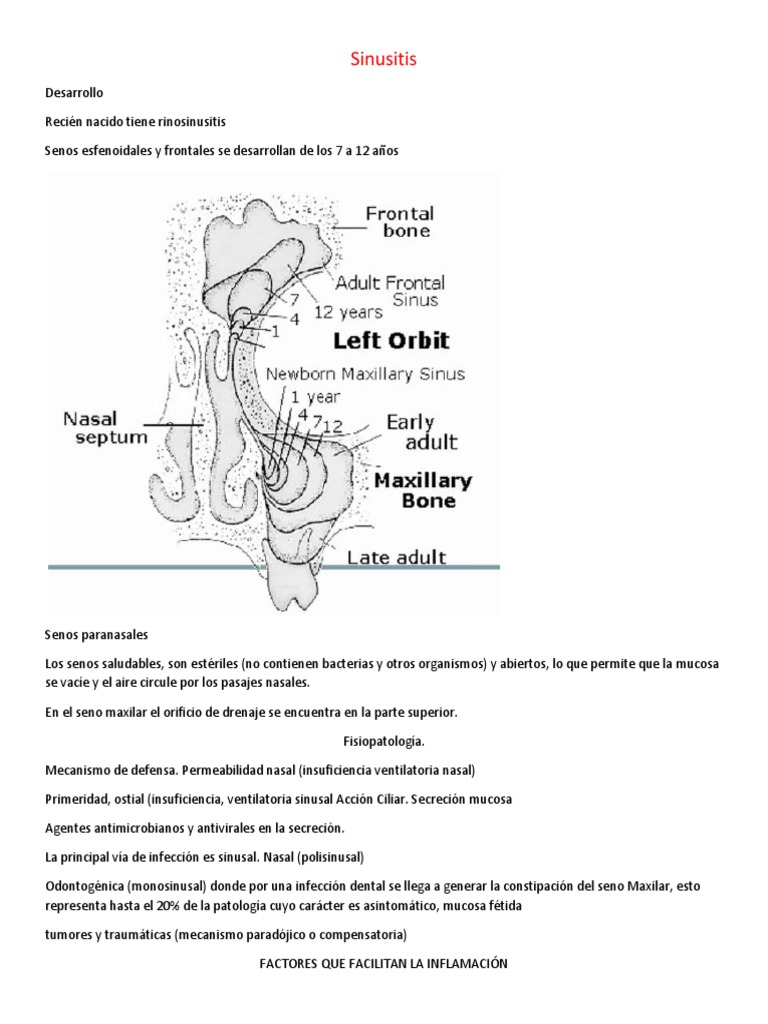 Sinusitis | PDF
