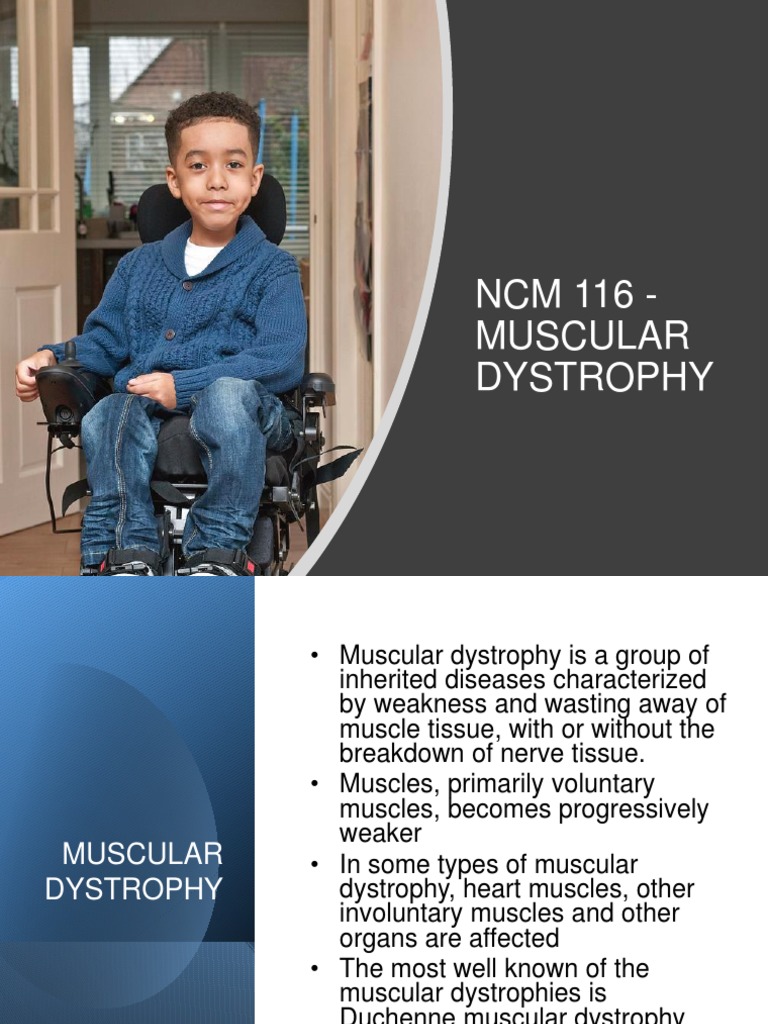 NCM 116 - Muscular Dystrophy | PDF