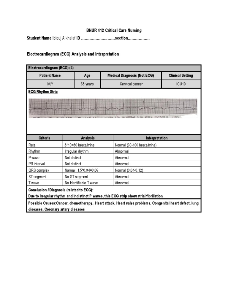 BNUR 412 ECG Assignment PDF | PDF