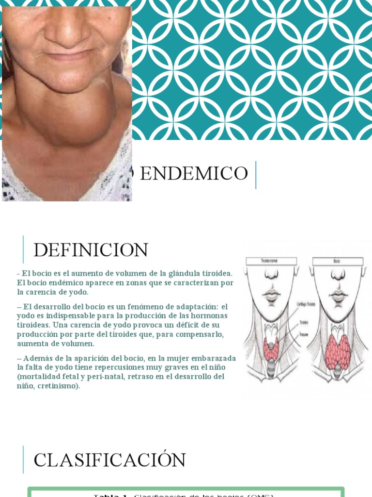 Bocio Endémico y Deficiencia de Yodo | PDF | Tiroides | Hormona ...