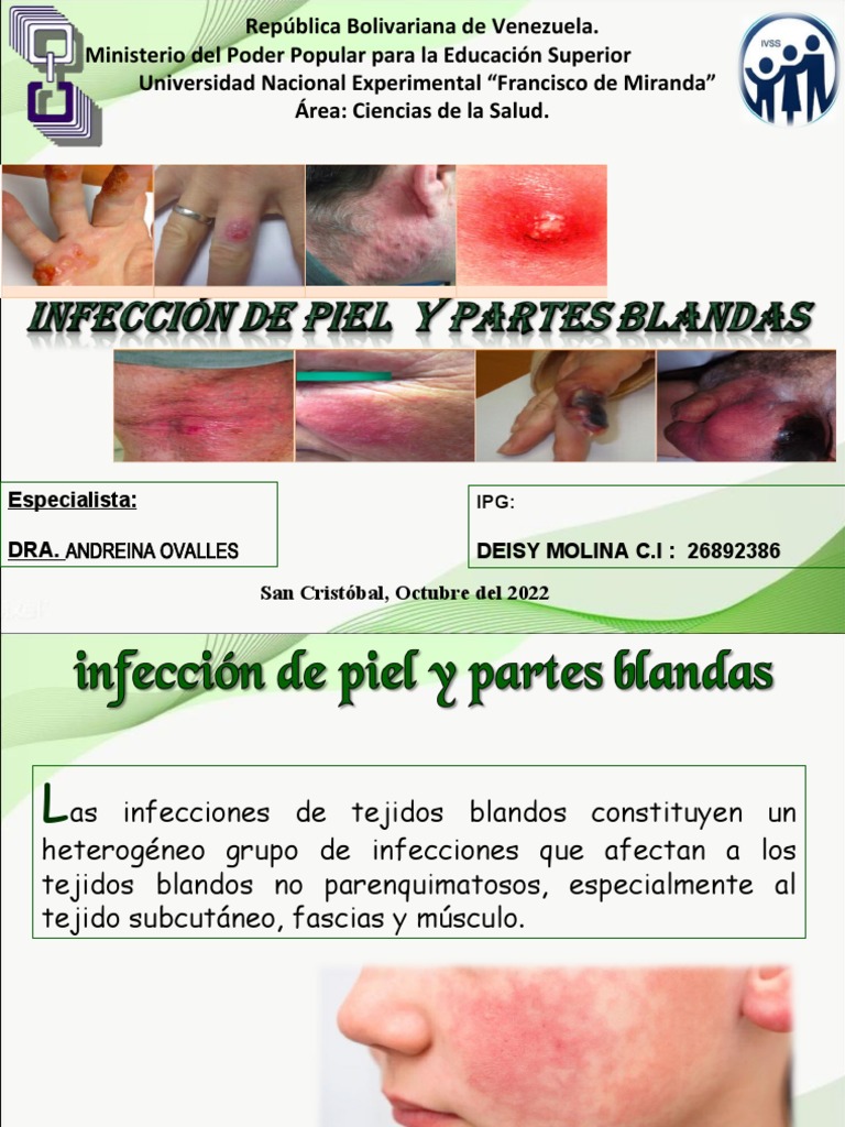 Guía infecciones tejidos blandos | PDF | Piel | Inmunología