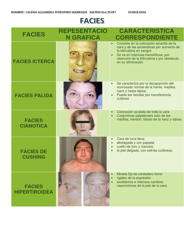 Tipos de Facies en Semiología Clínica | PDF | Anatomía | Anatomía humana