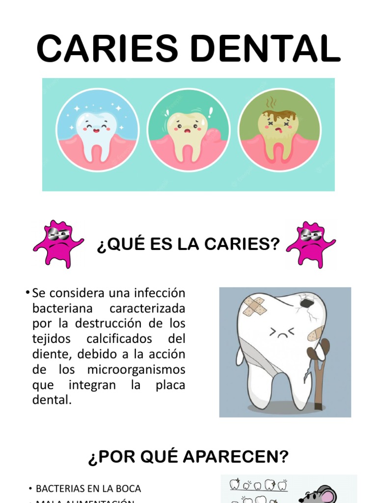 Caries Dental PDF | PDF