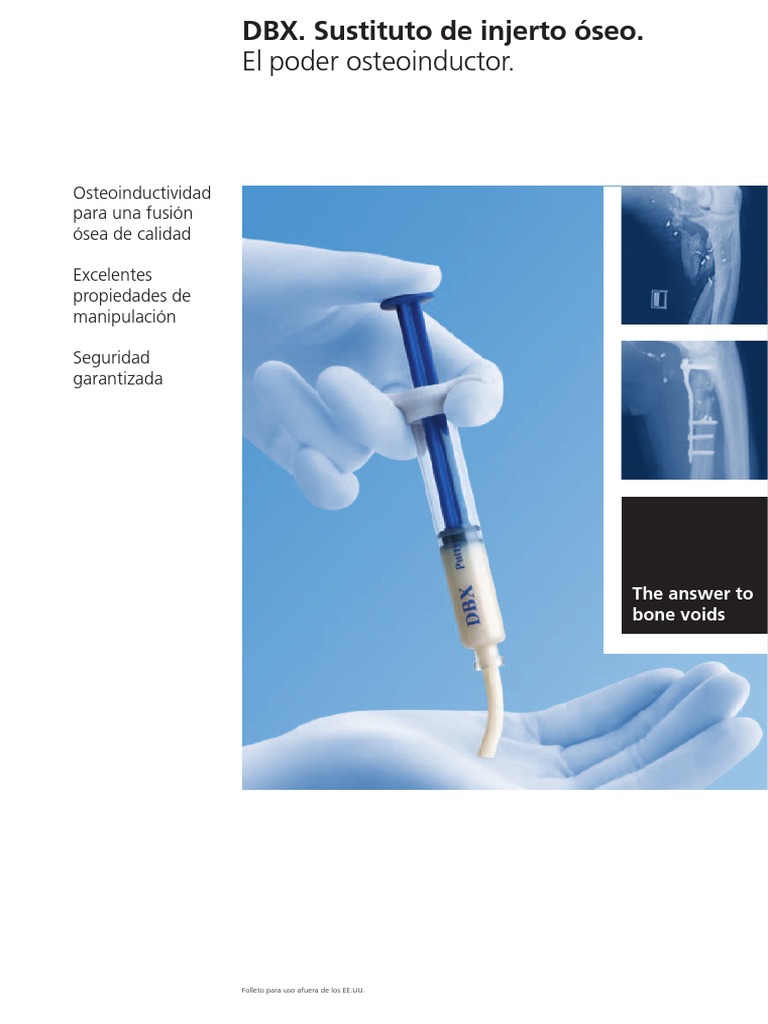 Sustituto de Injerto Oseo DBX | PDF