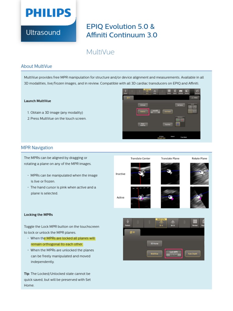 MultiVue Quick Guide (EPIQ Evolution 5.0 & Affiniti Continuum 3.0)Newpdf | PDF | Touchscreen ...