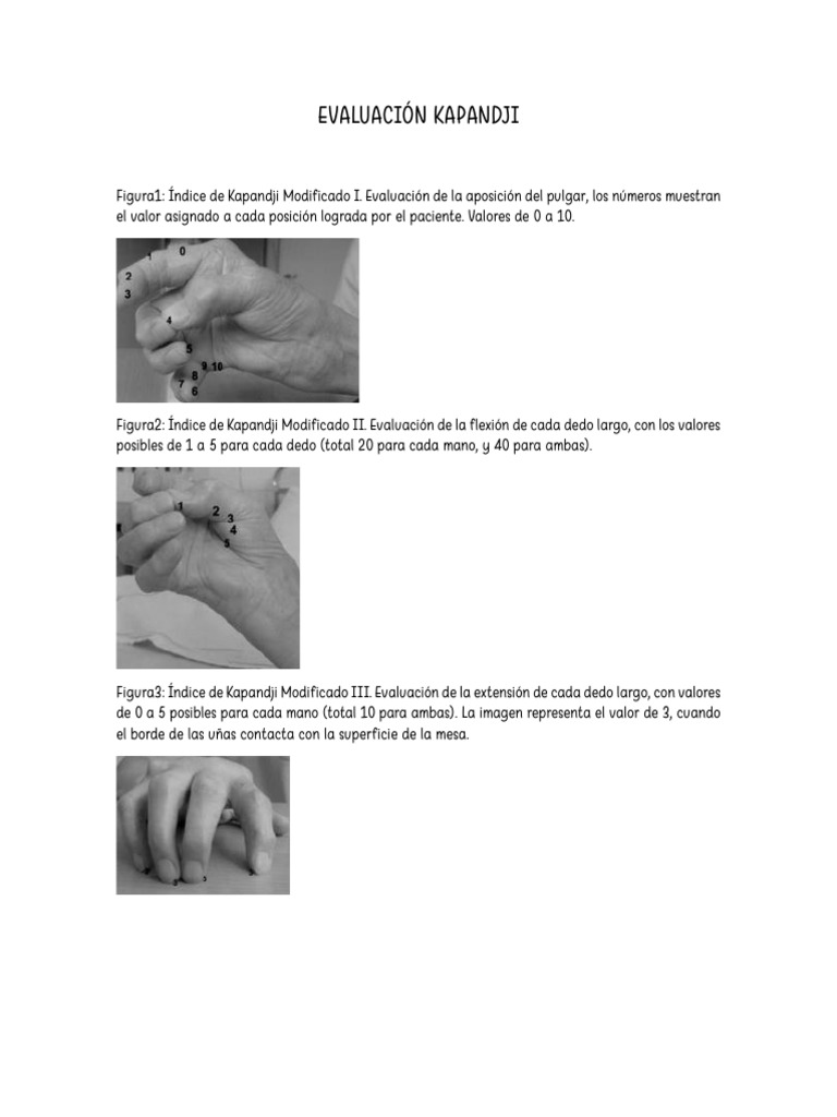 Evaluación Kapandji | PDF | Mano | Sistema musculoesquelético
