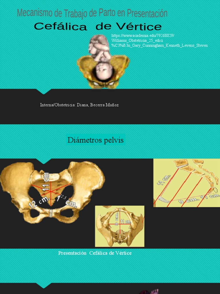 PRESENTACION CEFALICA DE VERTICE--DIANA-BECERRA.pptx | PDF | Parto ...
