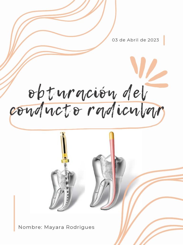 Obturación de conducto radicular | PDF