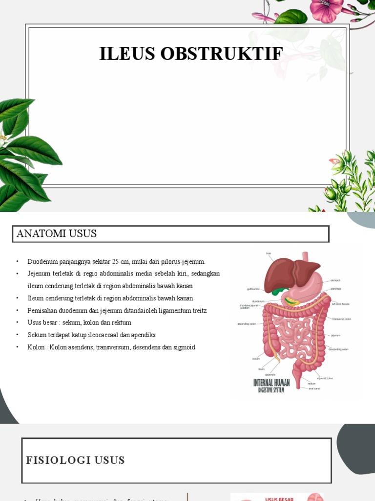 Ileus Obstruktif | PDF