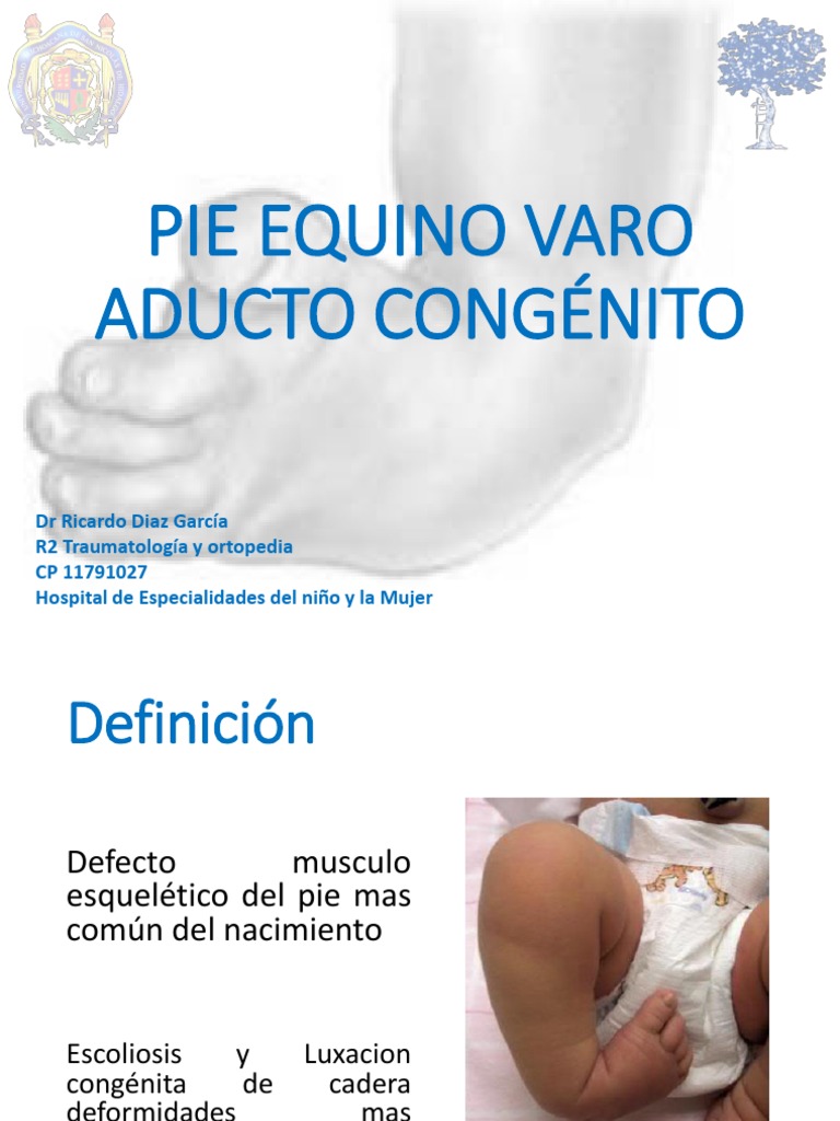 Pie Equino Varo Aducto Congénito | PDF