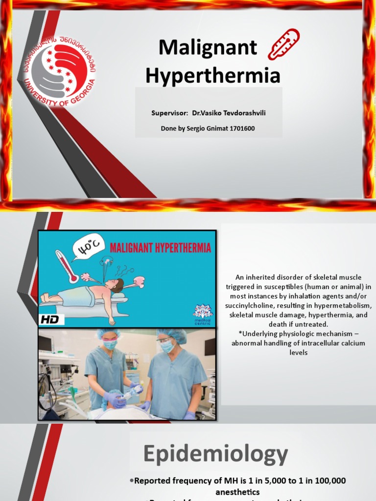 1 Malignant Hyperthermia PPT Sergio | PDF