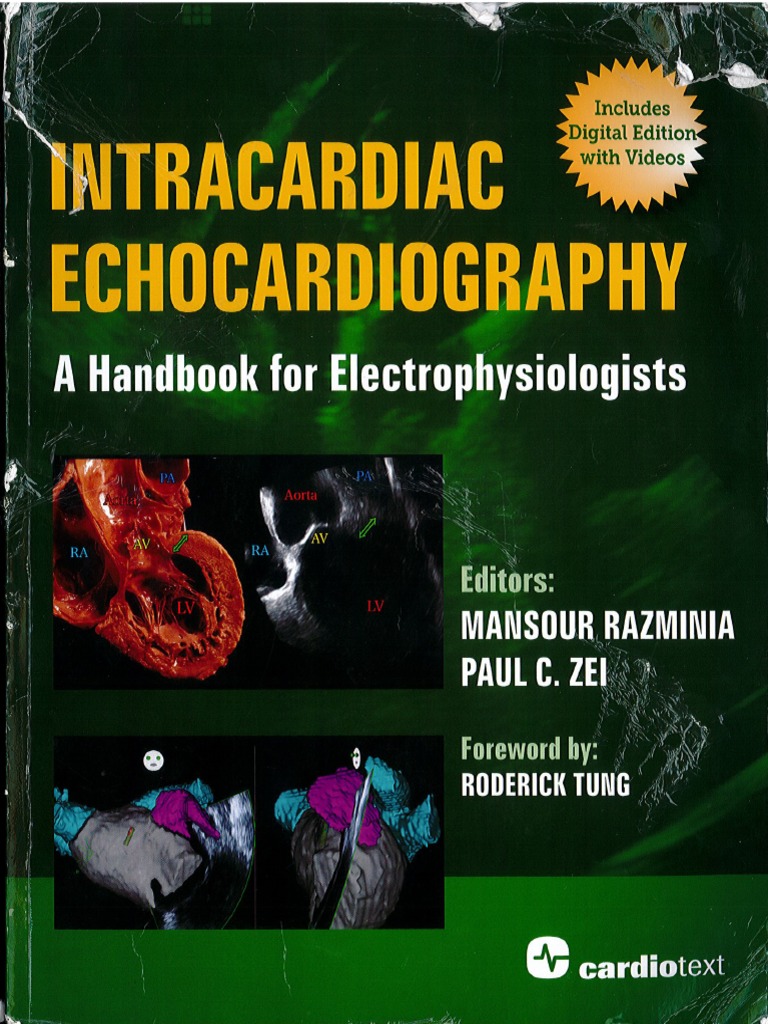 Intracardiac Echocardiography | PDF