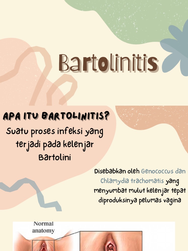 Bartolinitis PDF | PDF