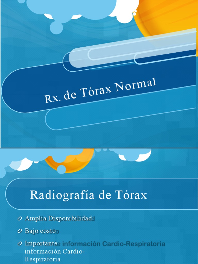RX Normal | PDF