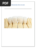 Prótesis Flexibles Valplast: Ventajas y Usos | PDF | Dentadura postiza ...
