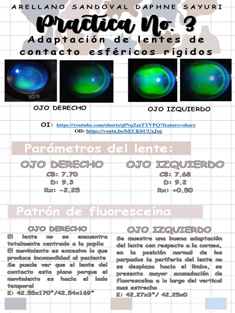 Practica 3 Lentes de Contacto | PDF