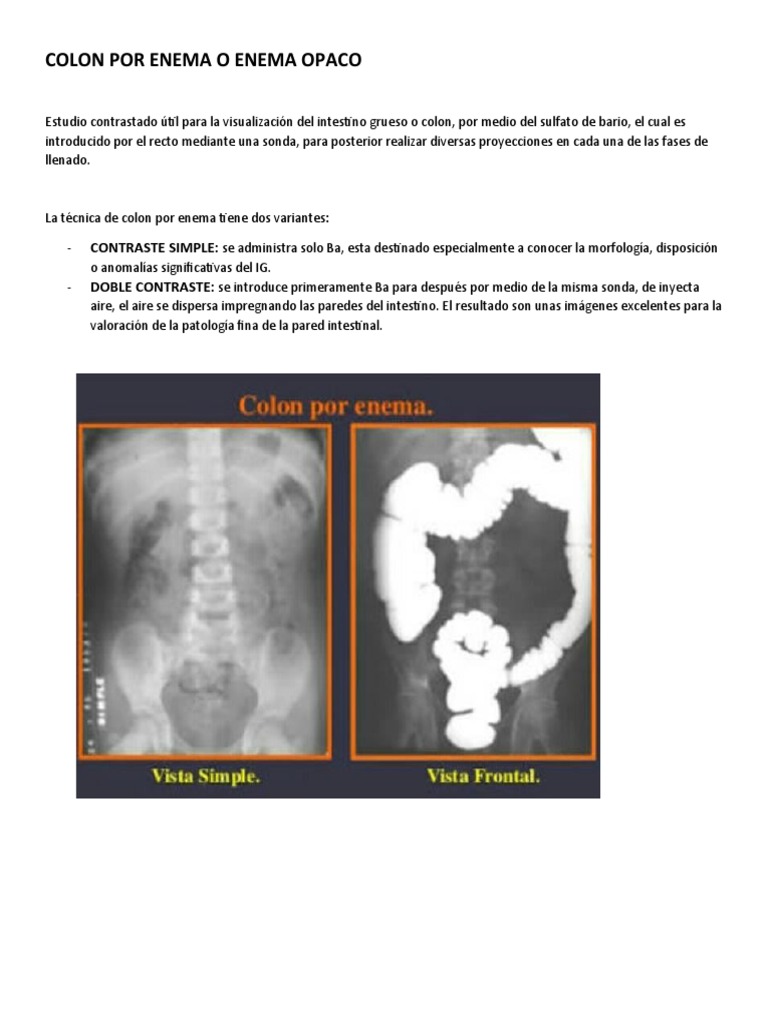 Colon Por Enema o Enema Opaco | PDF | Intestino grueso | Anatomía