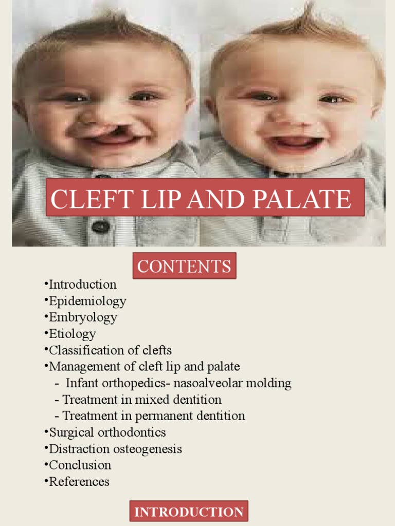 Cleft Lip and Palate | PDF | Orthodontics | Face