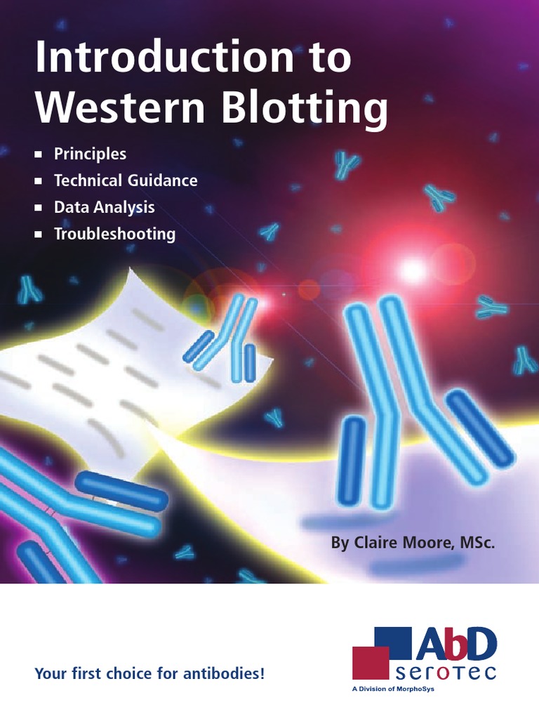 Introduction To Western Blot | PDF | Western Blot | Polyclonal B Cell Response