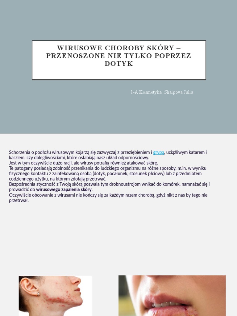Wirusowe choroby skóry – przenoszone nie tylko poprzez.pptx | PDF