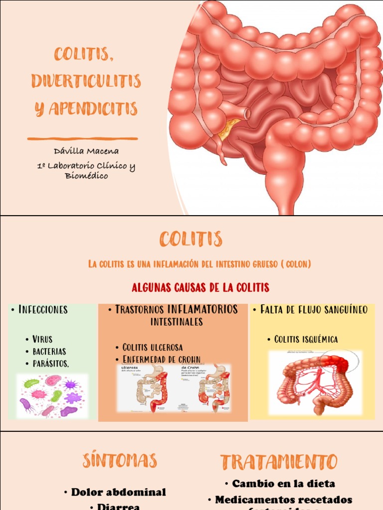 L Colitis, Diverticulitis y Apendicitis | PDF | Enfermedades y ...
