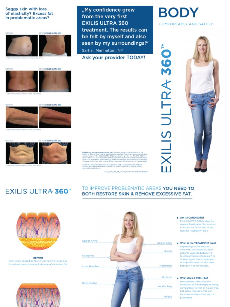 Exilis Ultra 360 Brochure Body 4k6feUgOVtqiPnO | PDF | Skin | Obesity