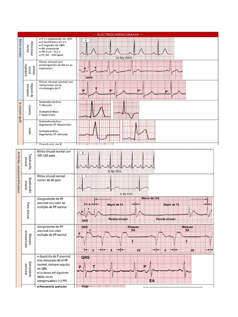 Imagenes Ekg | PDF