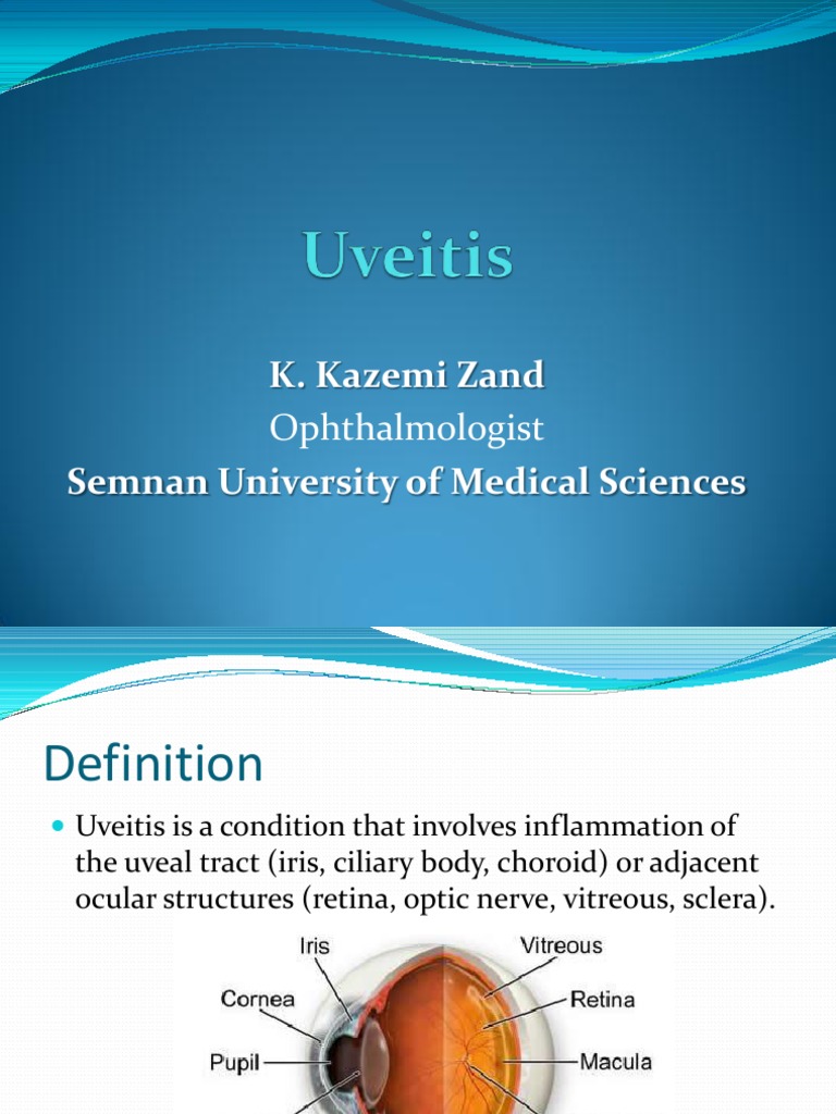 Uveitis PDF | Immunology | Ophthalmology