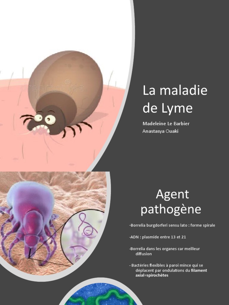 Est Ce Que La Maladie De Lyme Est Grave – NZHGK
