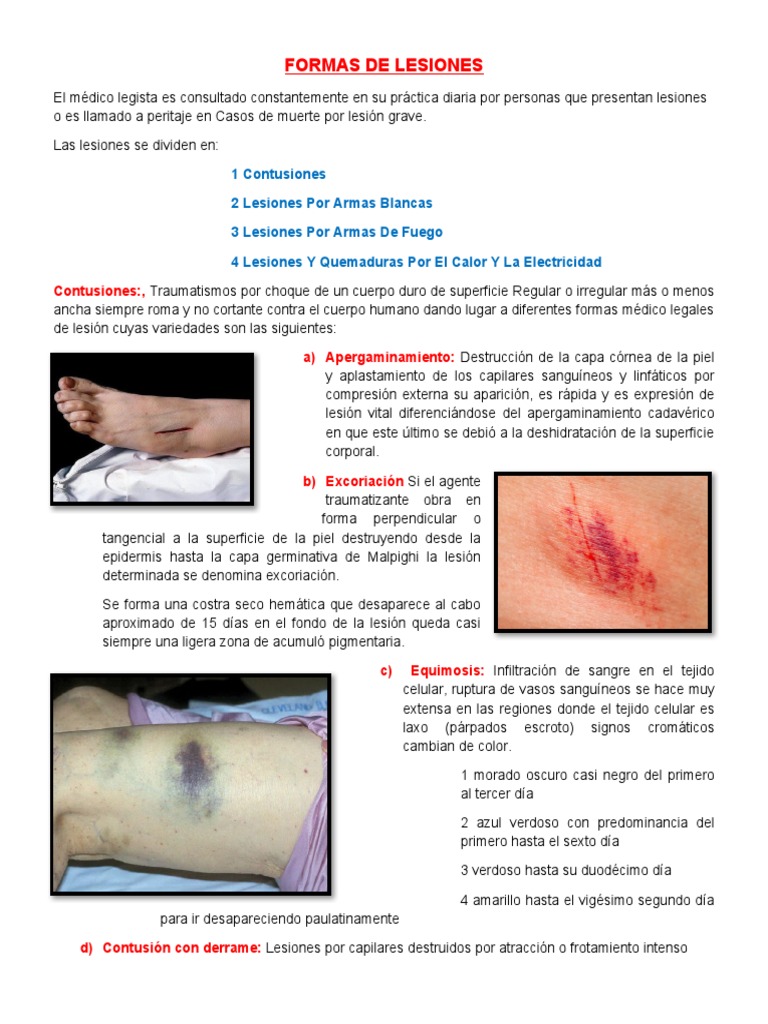 Tipos de Lesiones en Medicina Legal | PDF | Lesión | Anatomía