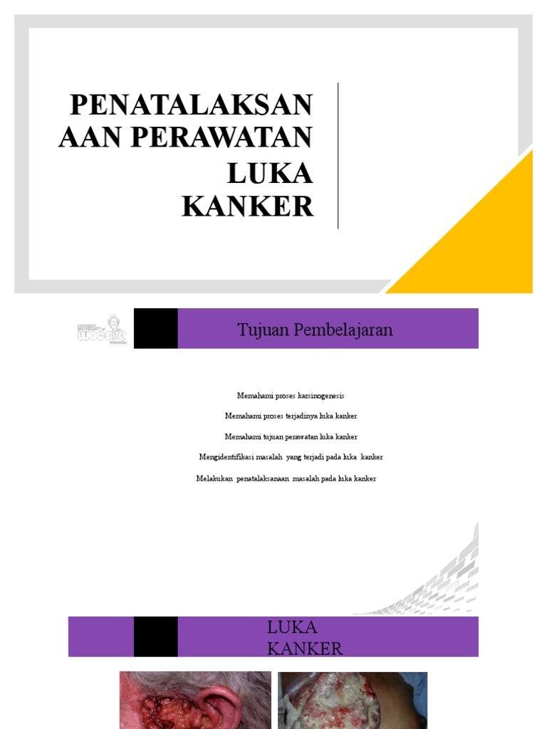 06 Luka Kanker 2022 | PDF | Cancer | Metastasis