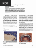 Rotational Path Removable Partial Denture Design | PDF | Dentures ...