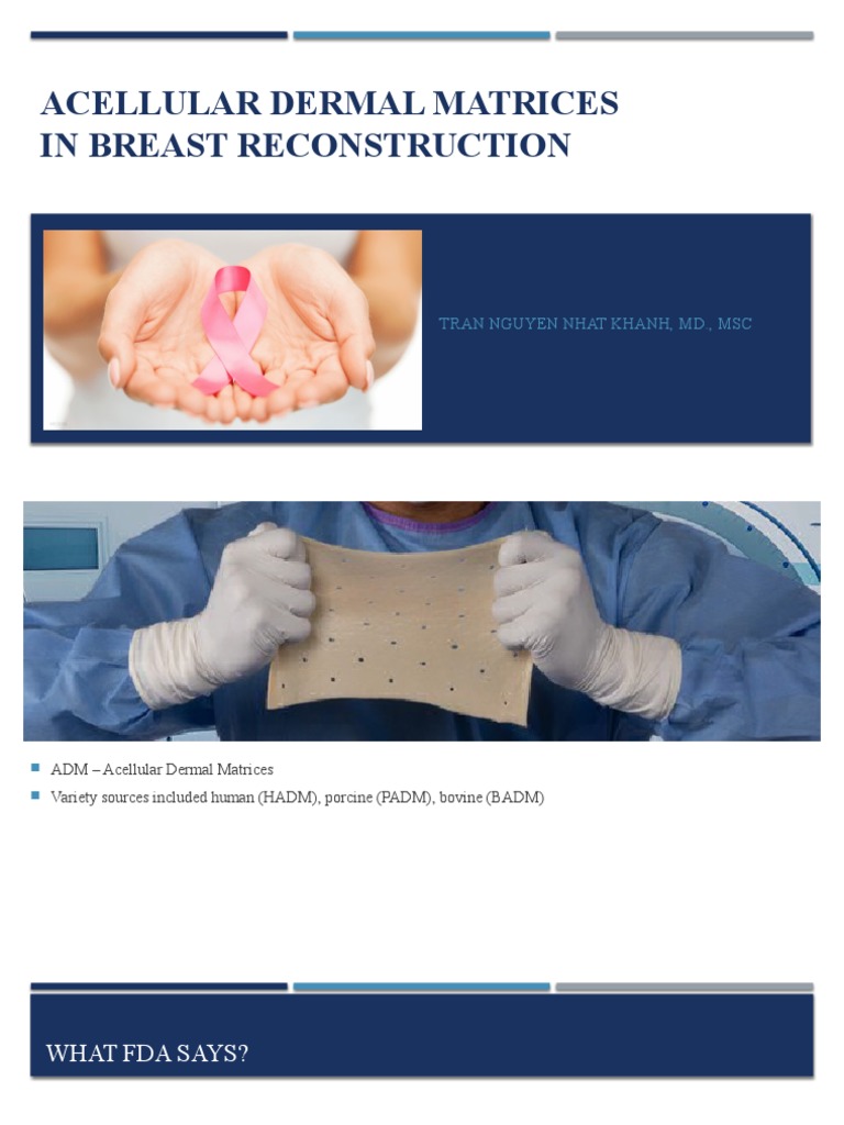 Acellular Dermal Matrices in Breast Reconstruction: Tran Nguyen Nhat ...