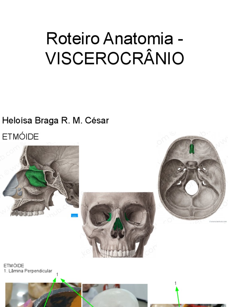 Anatomia do Viscerocrânio e Ossos Faciais | PDF | Anatomia | Sistema ...