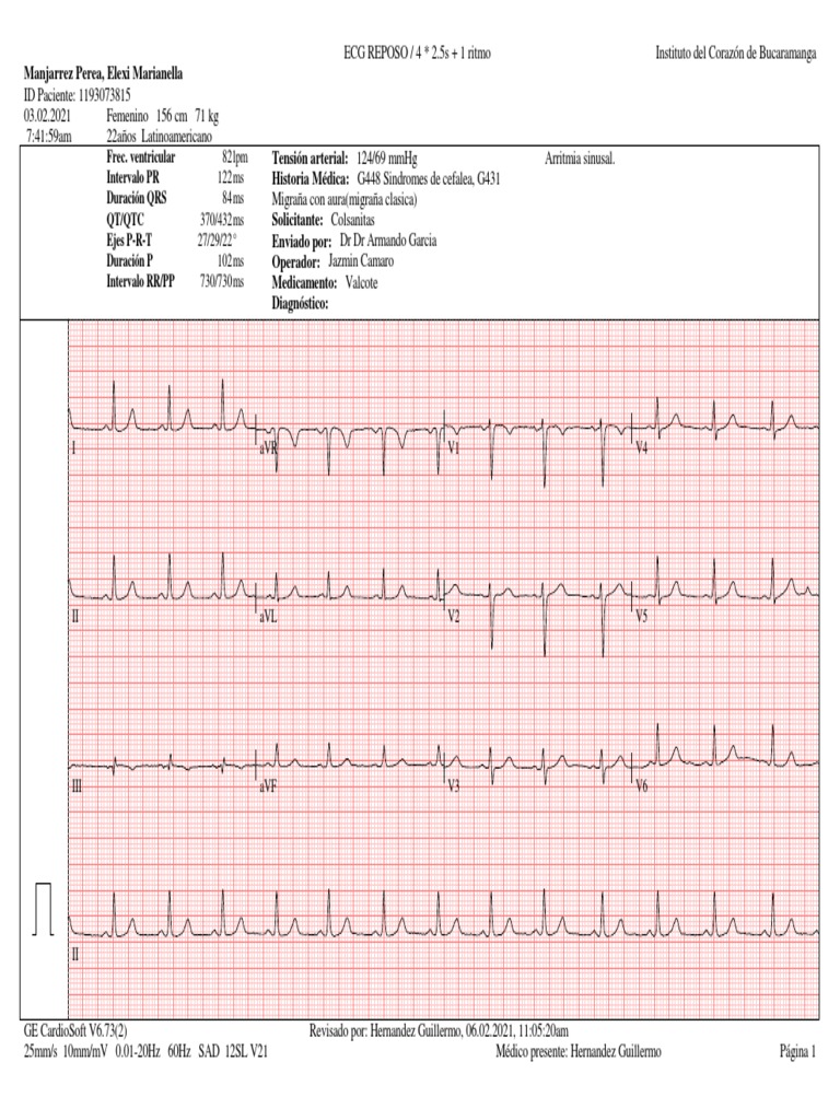 Corvette - Icb.bga - Co - Ecg - 2021 - 02 - 1193073815 YA PDF | PDF