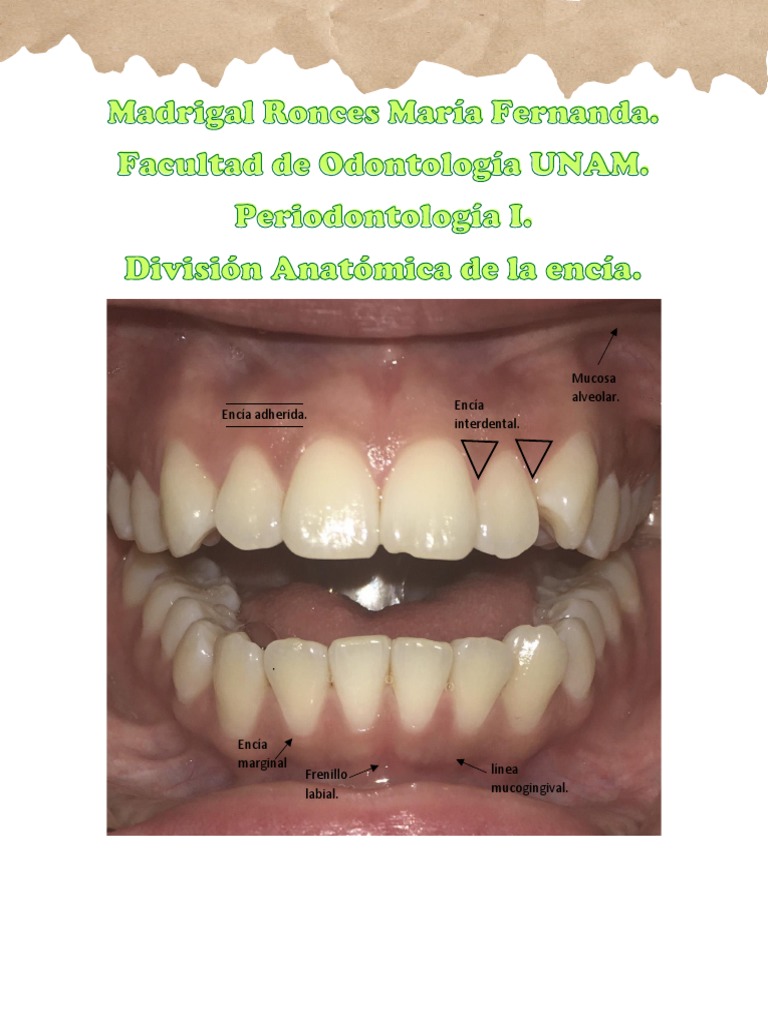 División Anatomica de La Encía. | PDF