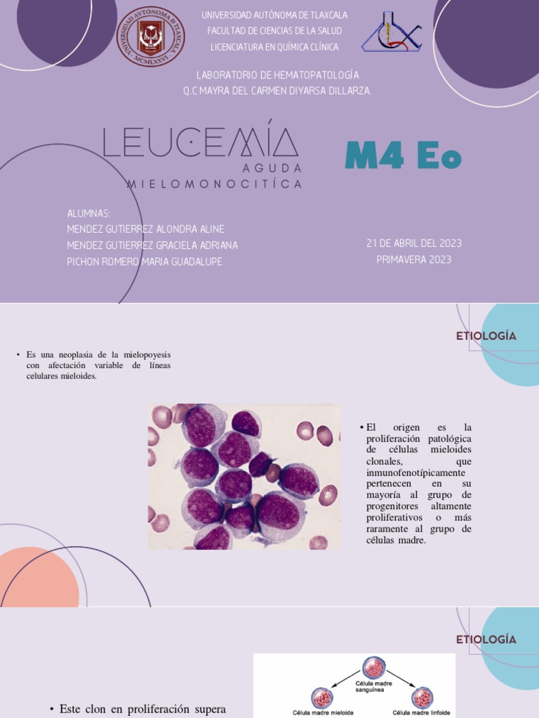 Leucemia Mielomonocítica Aguda M4Eo | PDF | Leucemia | Medicina CLINICA