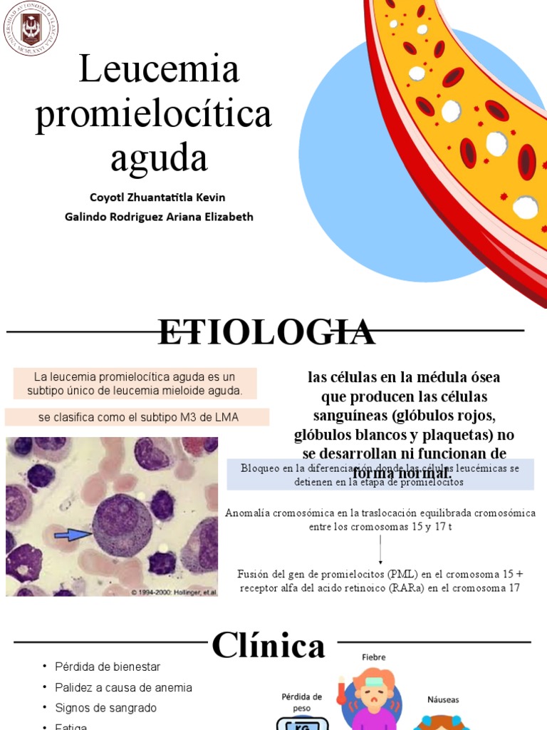 Leucemia Promielocítica Aguda | PDF | Leucemia | Especialidades Medicas
