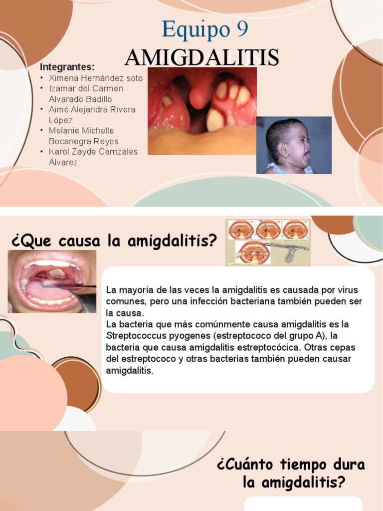 Amigdalitis | PDF