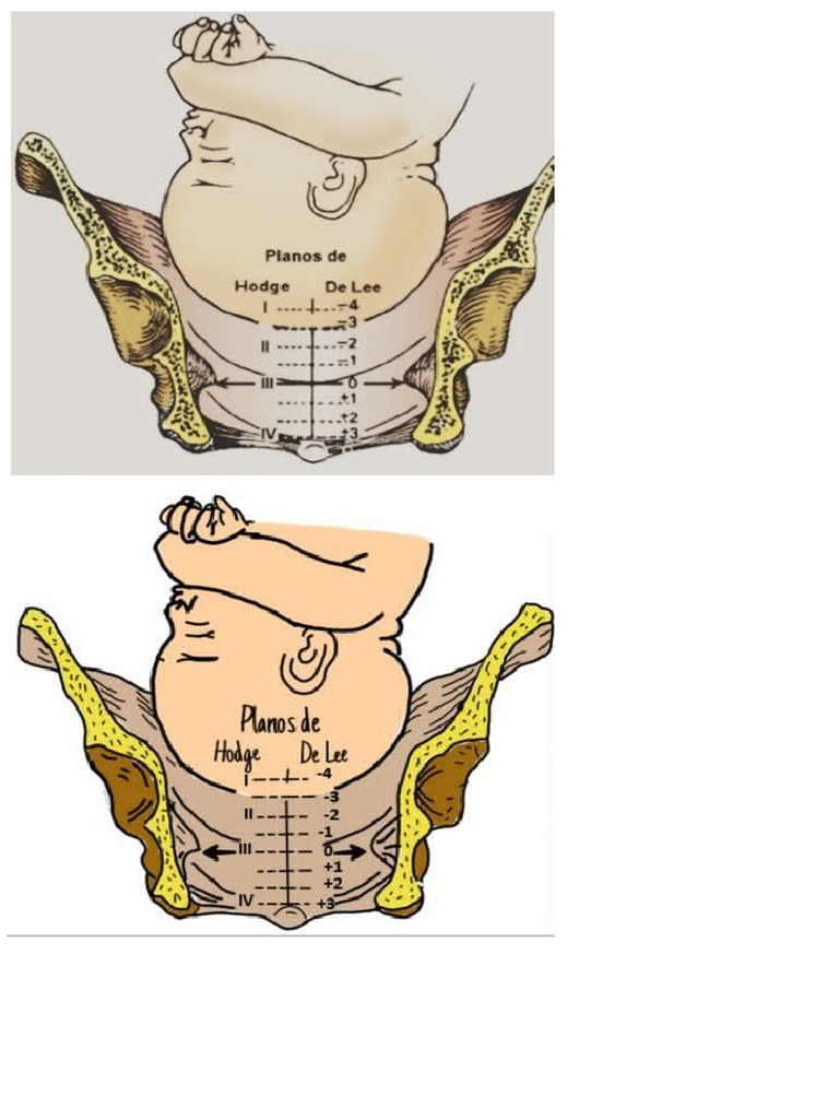 Planos de Hodge | PDF