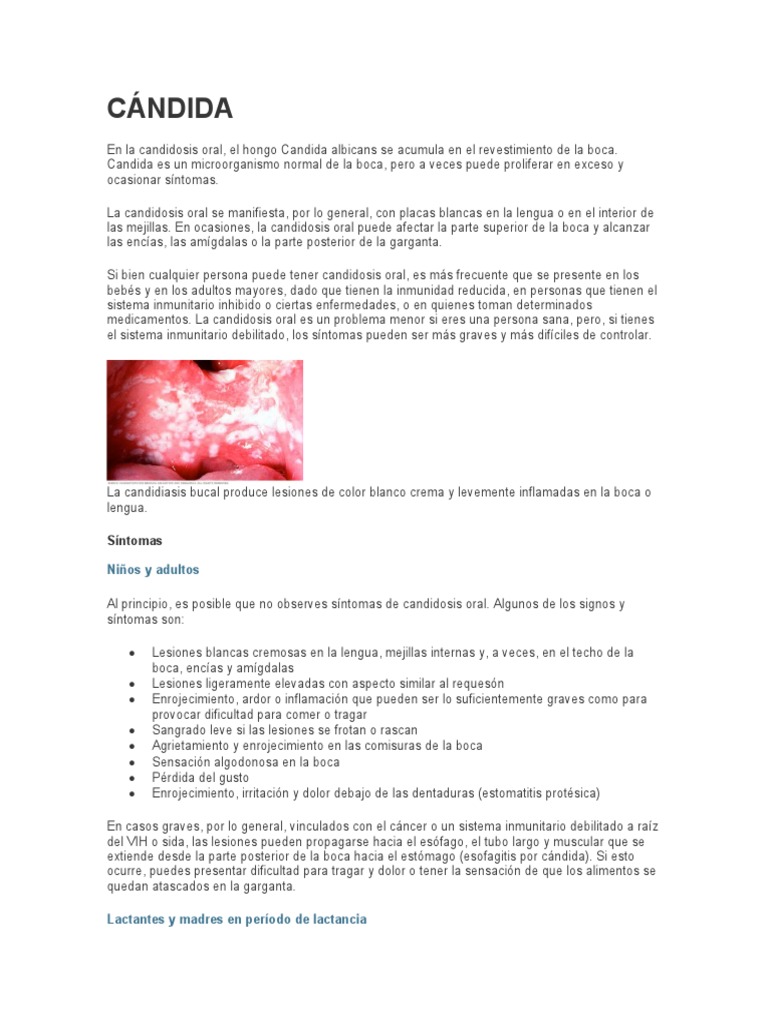 CÁNDIDA | PDF | Sistema inmune | Infección