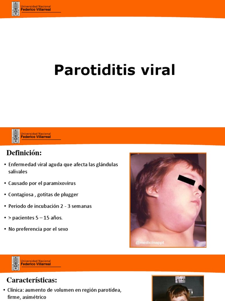 Parotiditis Viral: Síntomas y Tratamiento | PDF