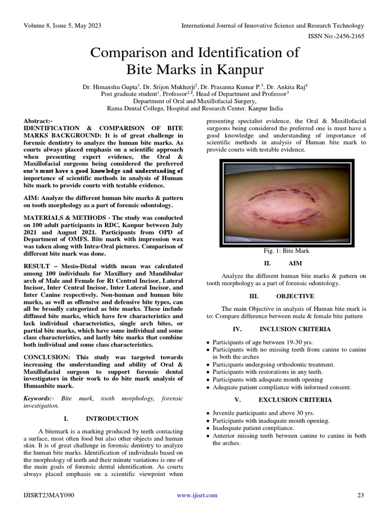 Comparison and Identification of Bite Marks in Kanpur | PDF | Dentistry ...