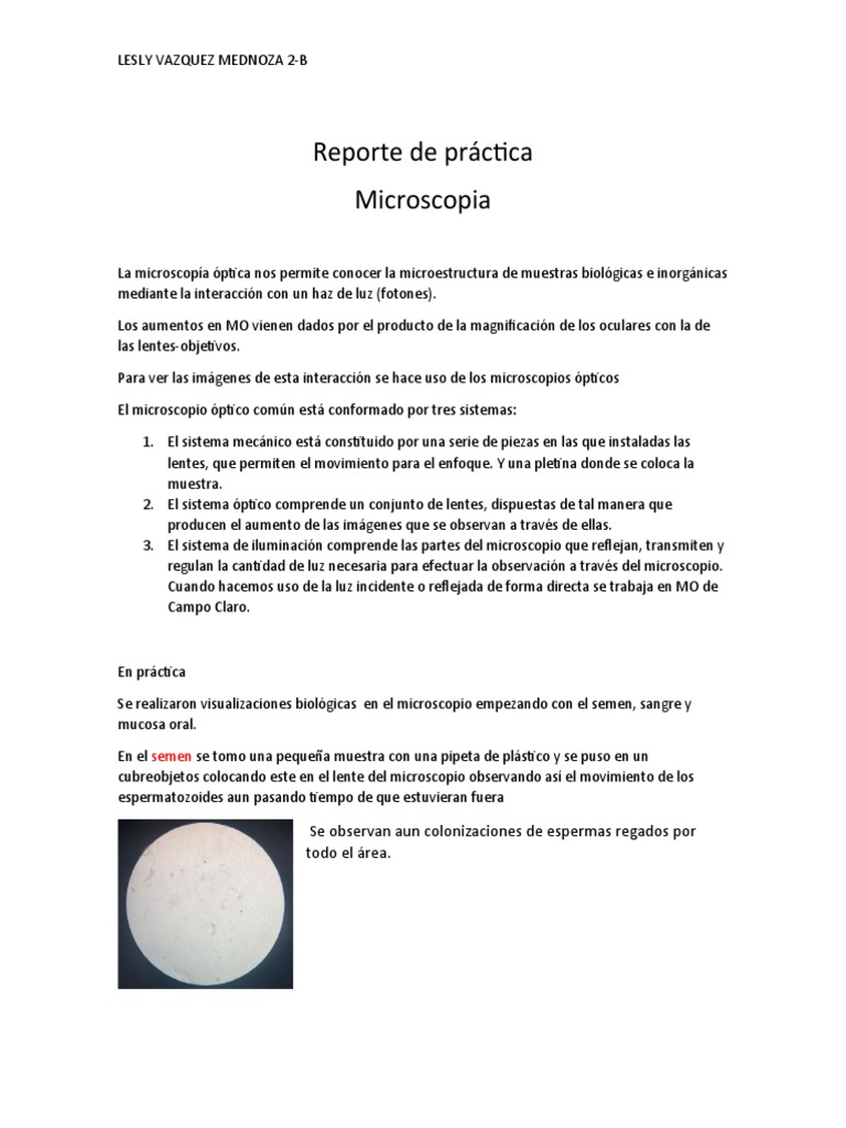 Reporte de Practica Microscopio | PDF