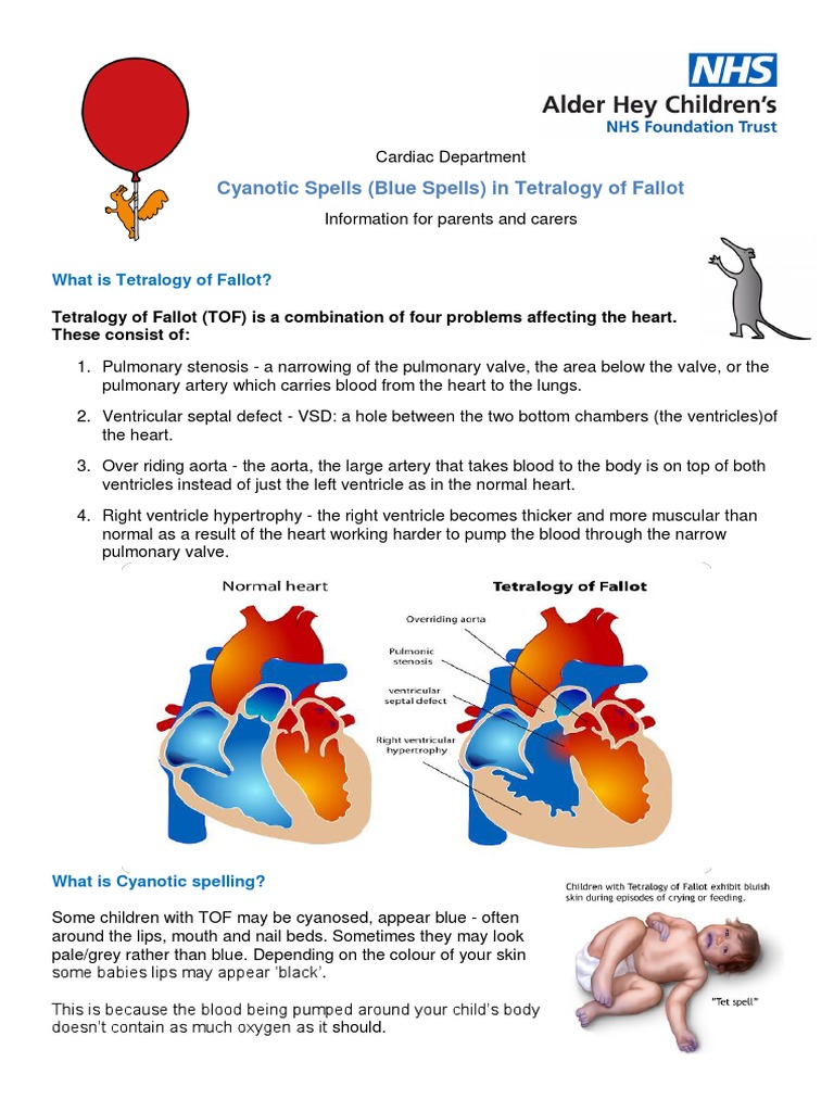 Cyanotic Spells Blue Spells in Tetralogy of Fallot - PIAG 214 | PDF | Heart | Ventricle (Heart)