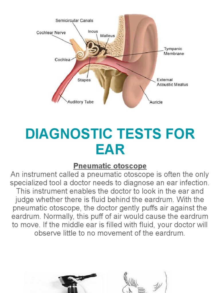 Diagnostic Tests For ENT | PDF | Electromyography | Allergy