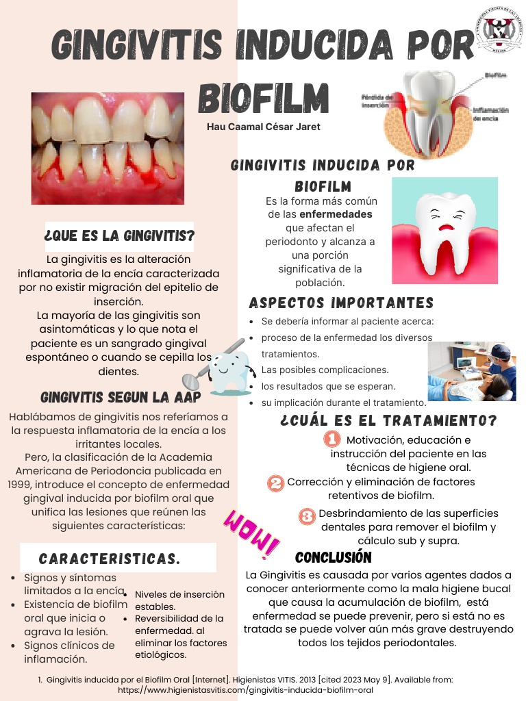 Gingivitis Inducida Por Biofilm PDF | PDF | Medicina | Causas de la muerte
