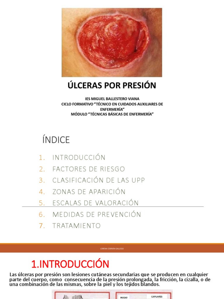 Clasificación de Úlceras por Presión | PDF | Herida | Colchón